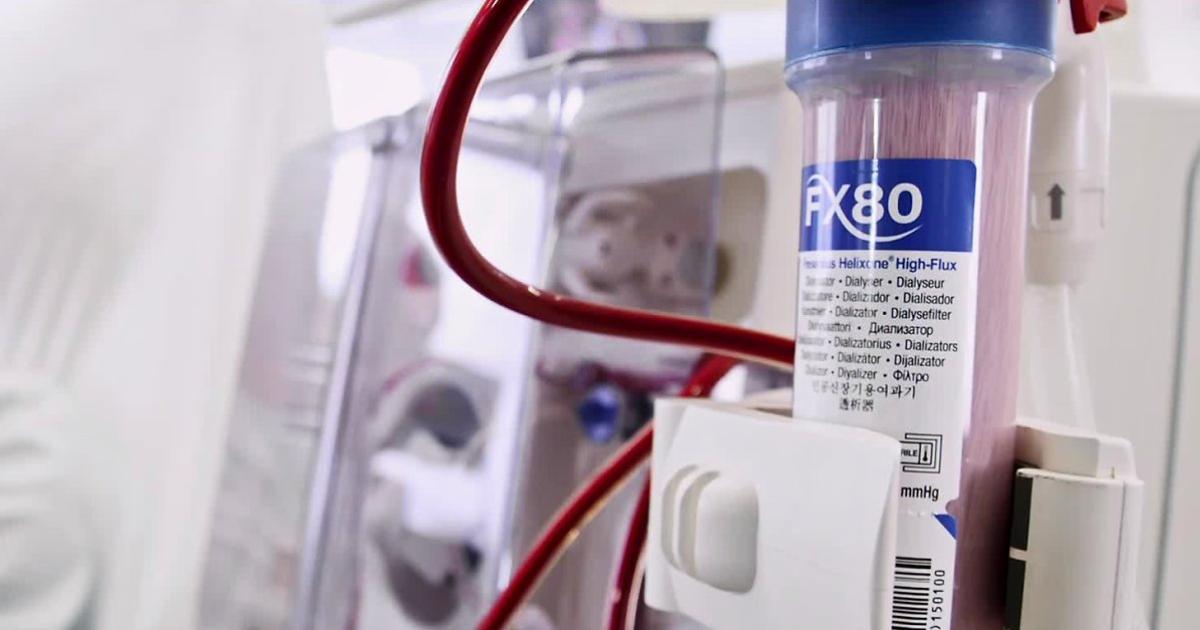 Fresenius Medical Care delivers strong first quarter 2017 | FSE